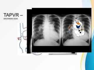 Tapvr Snowman Sign In