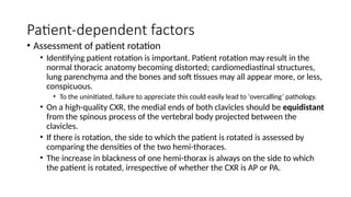 CXR approach to cardiac disease (1).pptx