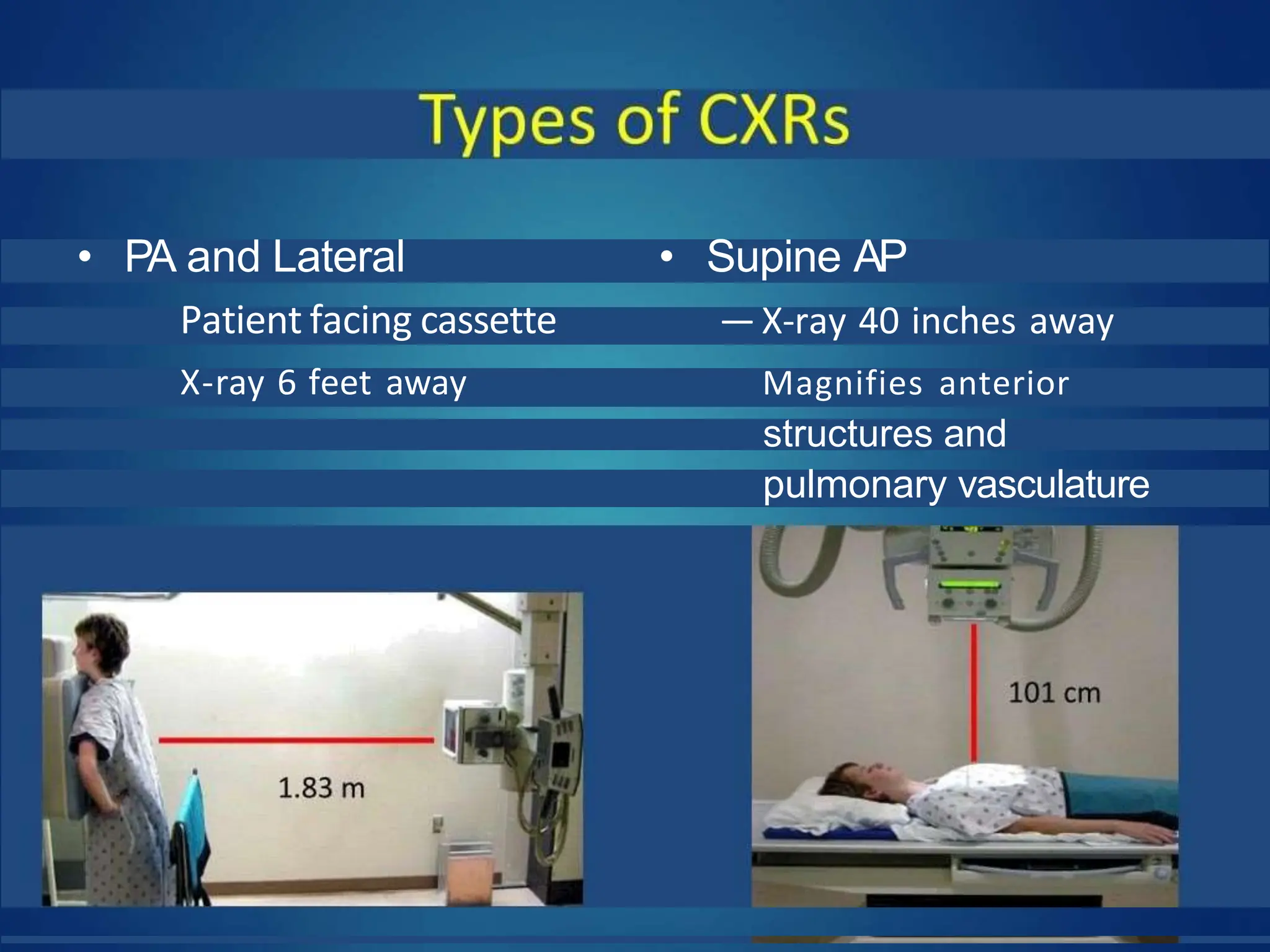 basics about chest x ray for all branches of medical science.pptx