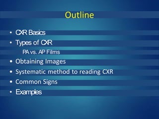 basics about chest x ray for all branches of medical science.pptx
