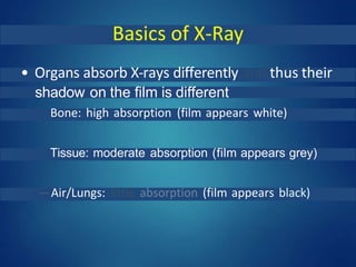 basics about chest x ray for all branches of medical science.pptx