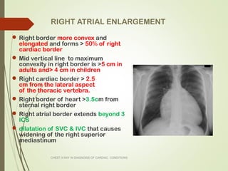 Left Atrial Enlargement X Ray