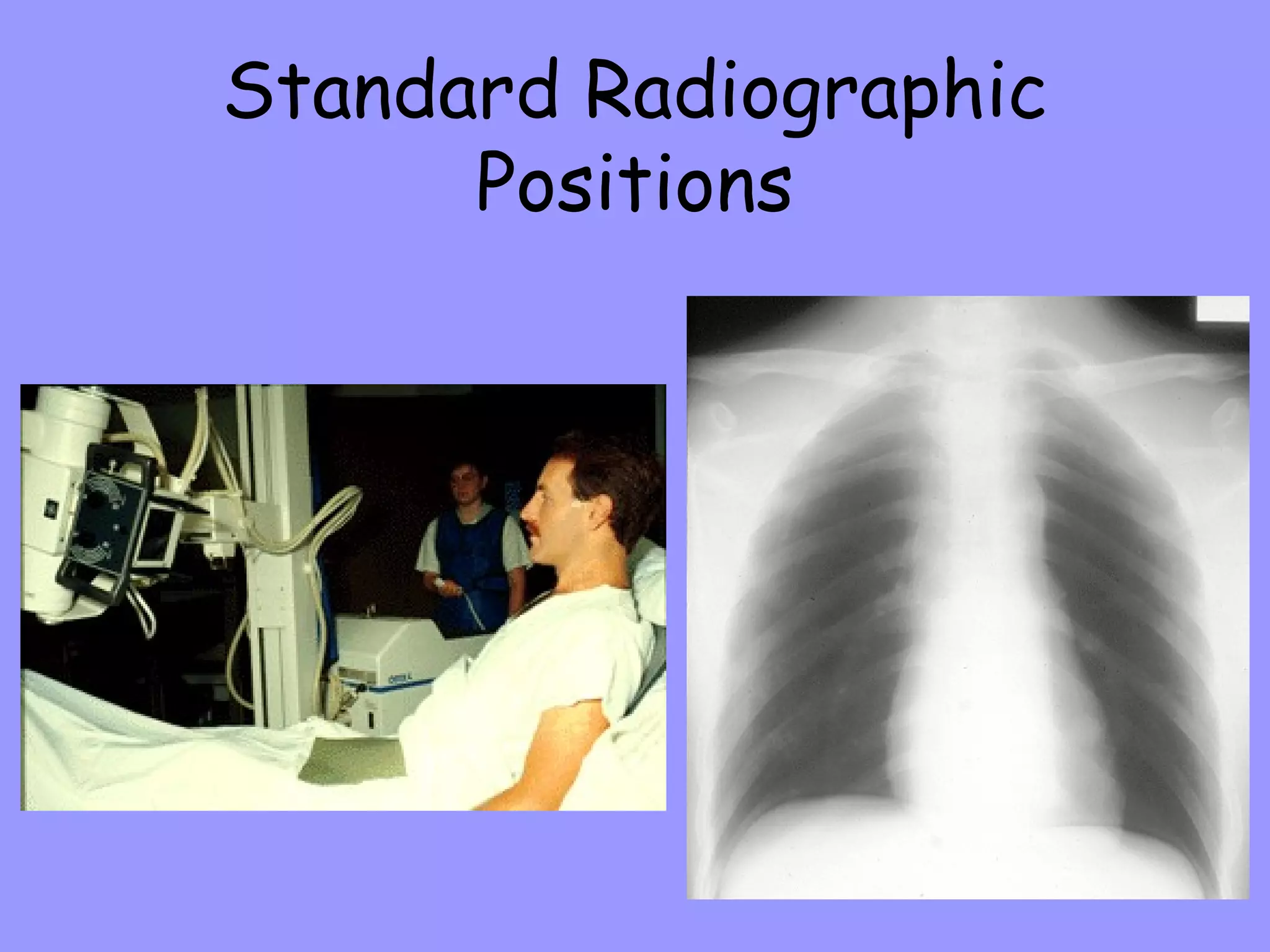 Interpretation of Chest X-Ray PPT | PPT