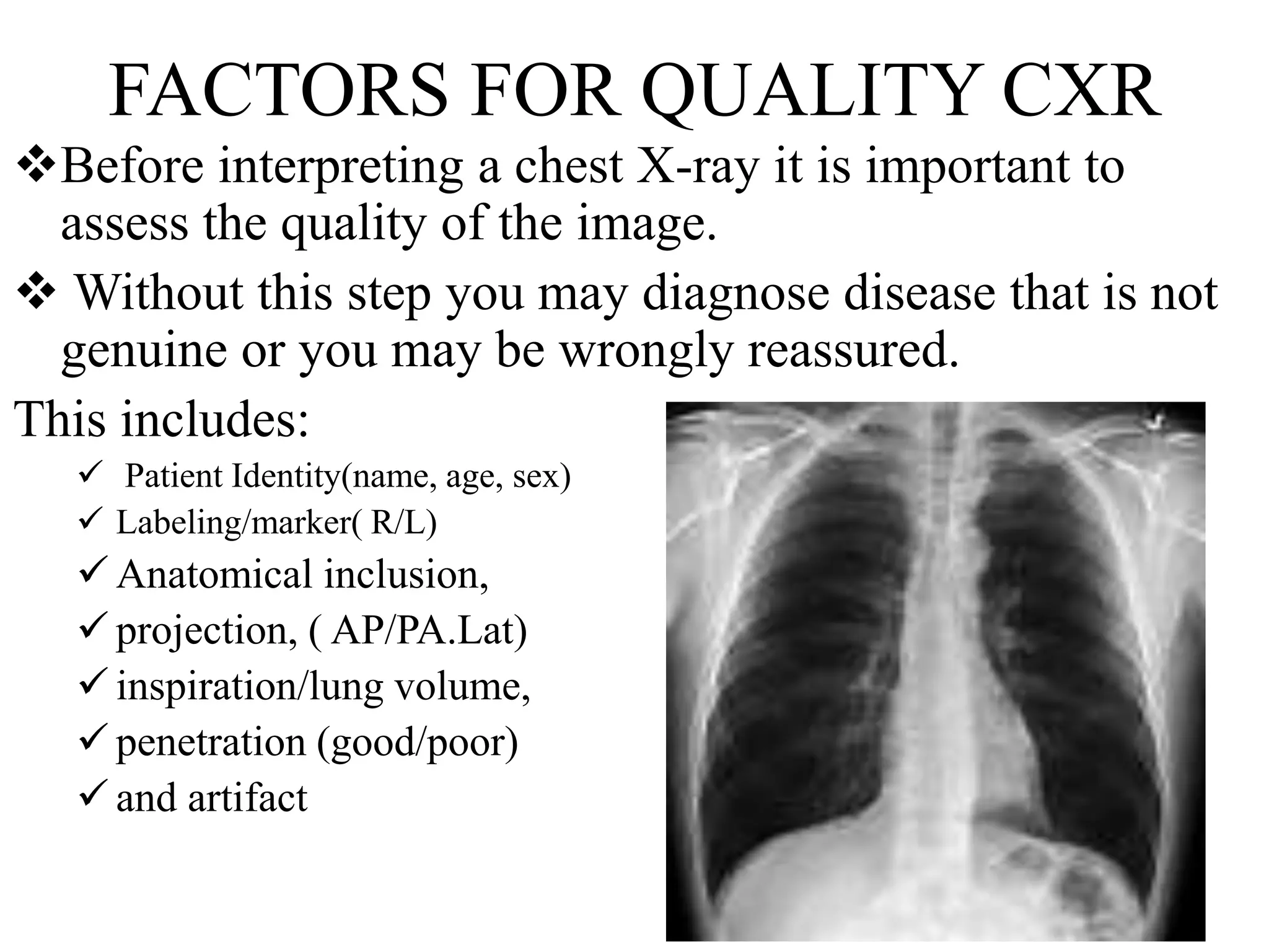 CXR interpretation in TB patients | PPTX