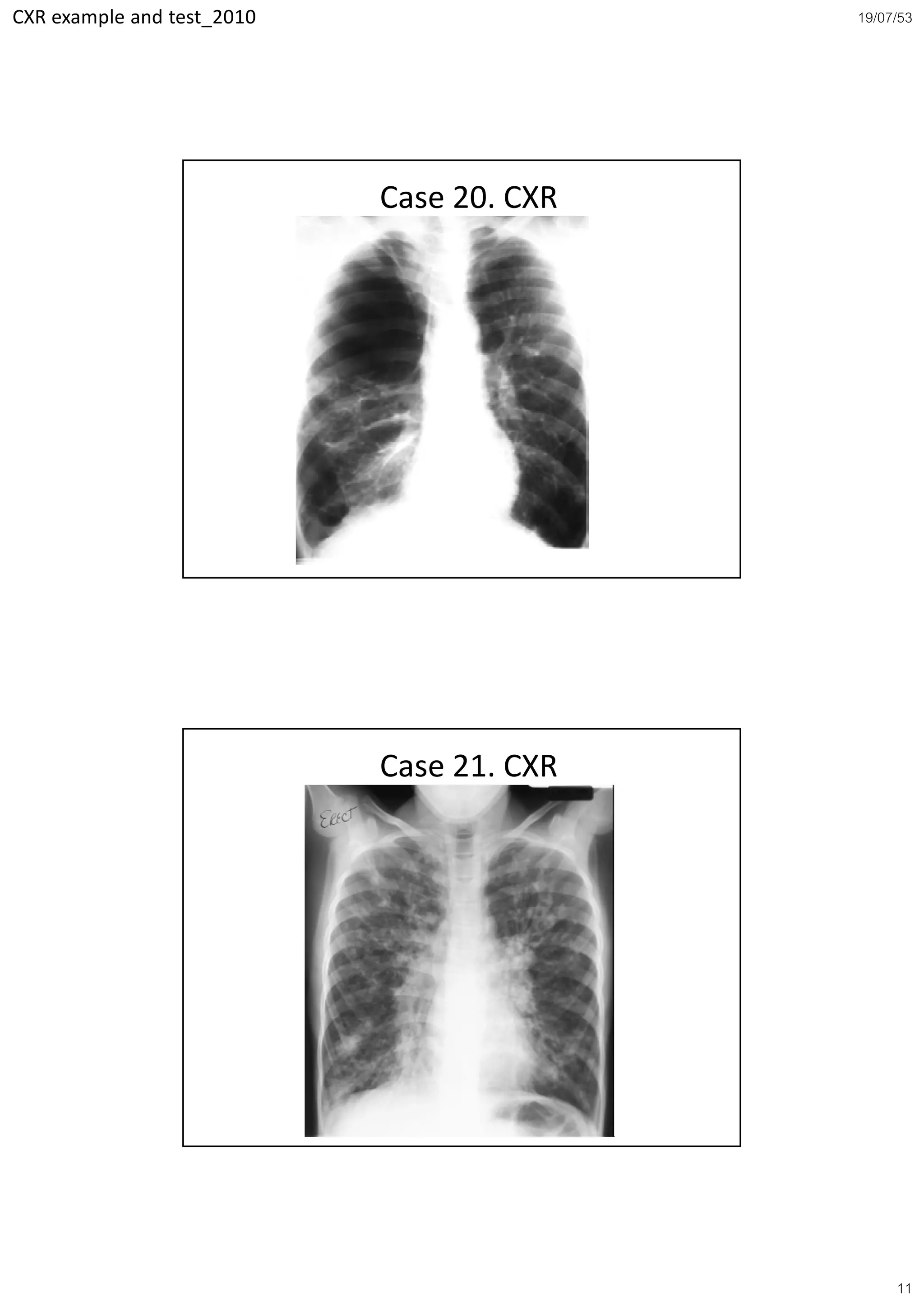 Cxr example and test 2010 | PDF