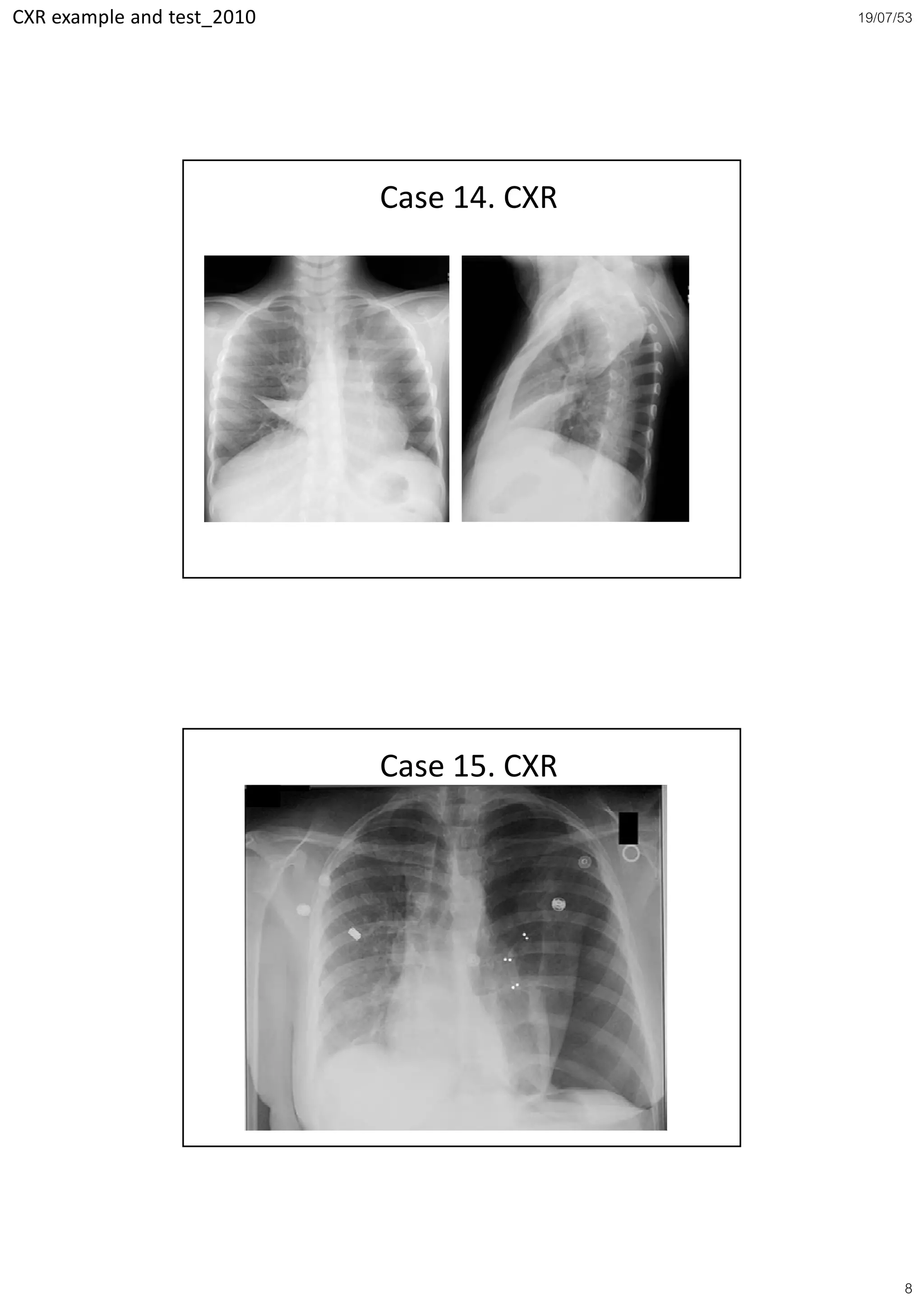 Cxr example and test 2010 | PDF