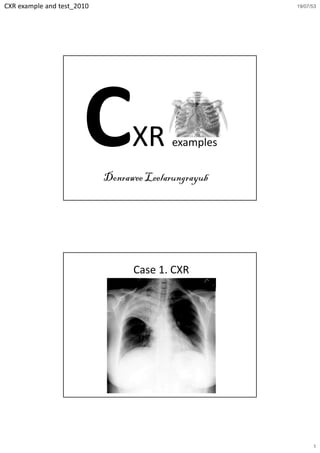 Cxr example and test 2010 | PDF