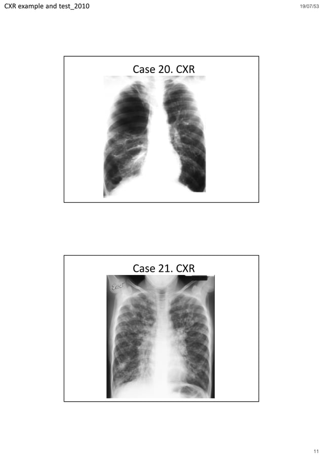 Cxr example and test 2010 | PDF