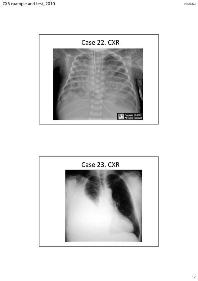 Cxr example and test 2010 | PDF