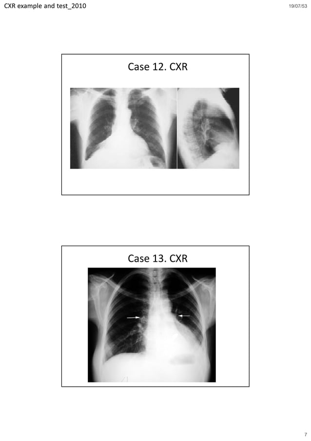 Cxr example and test 2010 | PDF