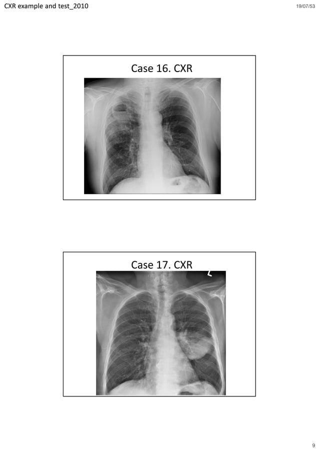 Cxr example and test 2010 | PDF