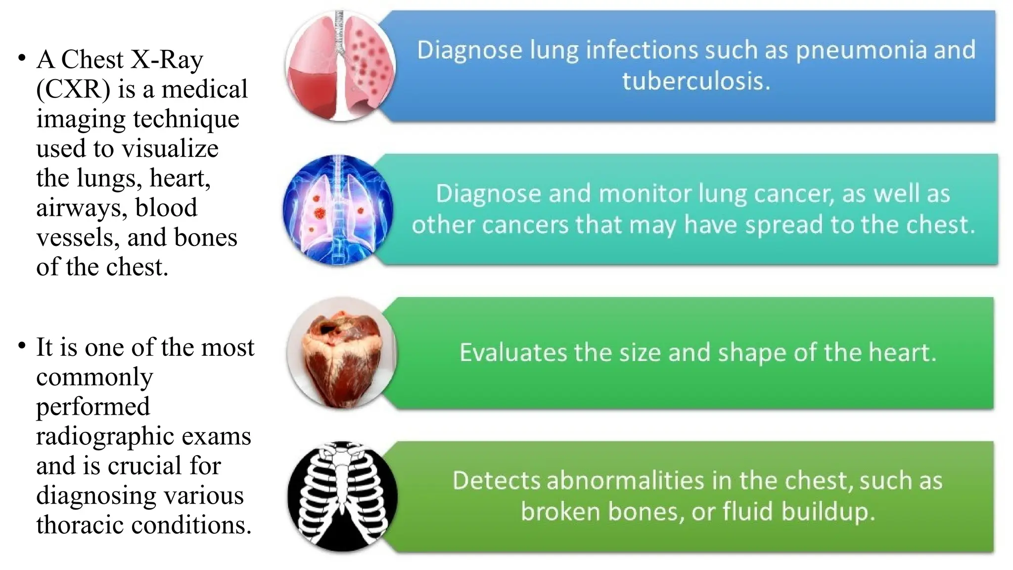 Chest X-Ray (CXR) Interpretation Made Easy: A Comprehensive Guide to ...