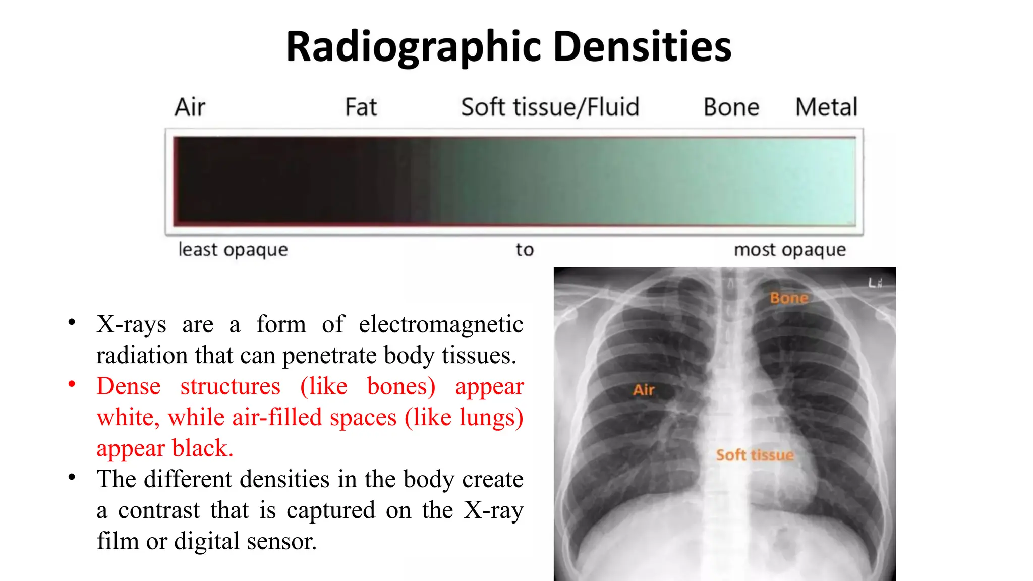 Chest X-Ray (CXR) Interpretation Made Easy: A Comprehensive Guide to Common Chest Pathologies | PPTX