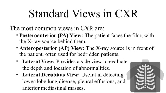 Chest X-Ray (CXR) Interpretation Made Easy: A Comprehensive Guide to ...