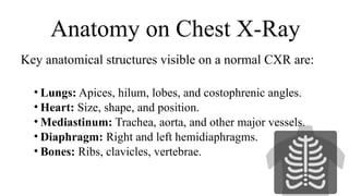 Chest X-Ray (CXR) Interpretation Made Easy: A Comprehensive Guide to ...