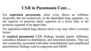 Chest X-Ray (CXR) Interpretation Made Easy: A Comprehensive Guide to ...