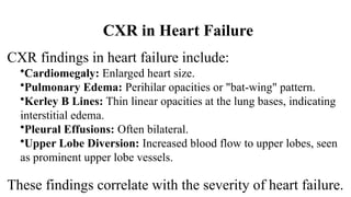 Chest X-Ray (CXR) Interpretation Made Easy: A Comprehensive Guide to ...