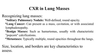Chest X-Ray (CXR) Interpretation Made Easy: A Comprehensive Guide to ...