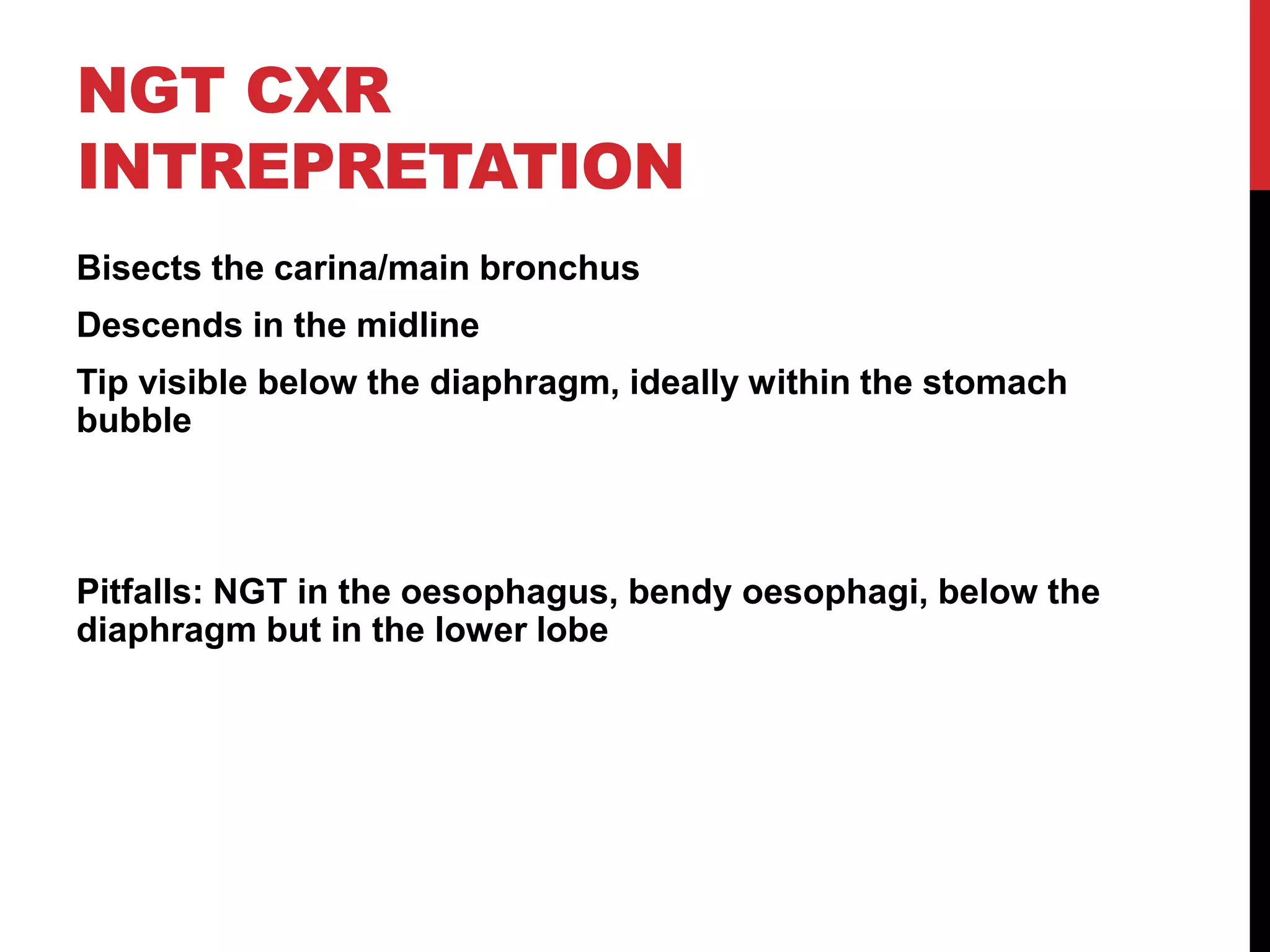 Cxr interpretation | PPTX