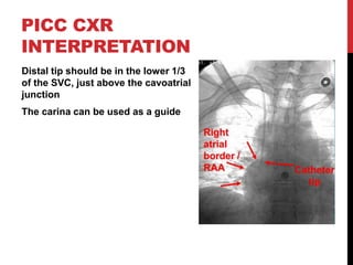 Cxr interpretation | PPTX