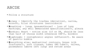 Chest X-ray Interpretation Structure and Tips | PPTX | Lung and ...