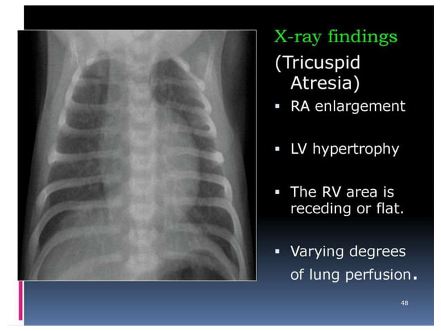 Cxr of common heart pathology agp | PPTX