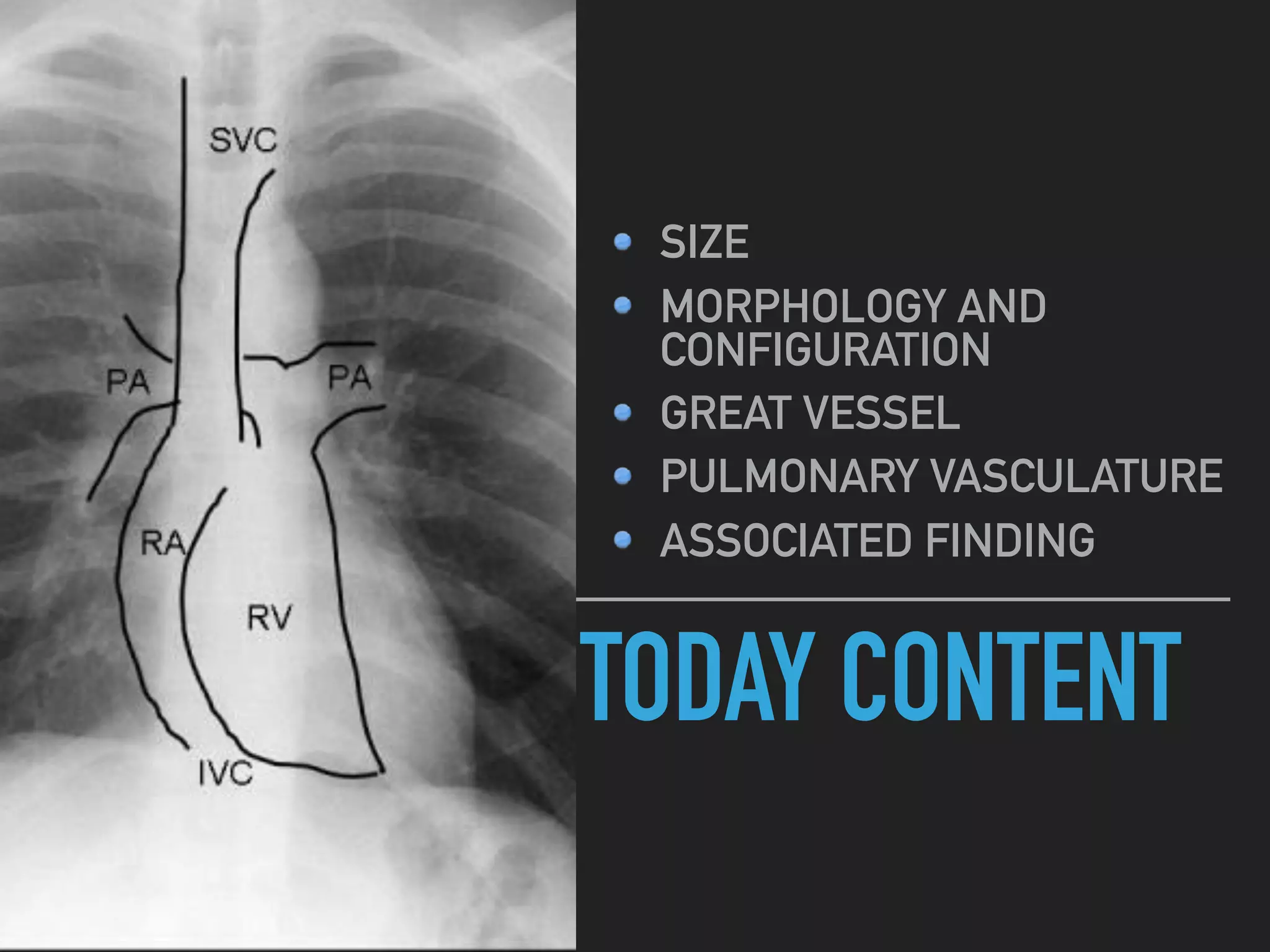 Chest film in cardiovascular system | PPT