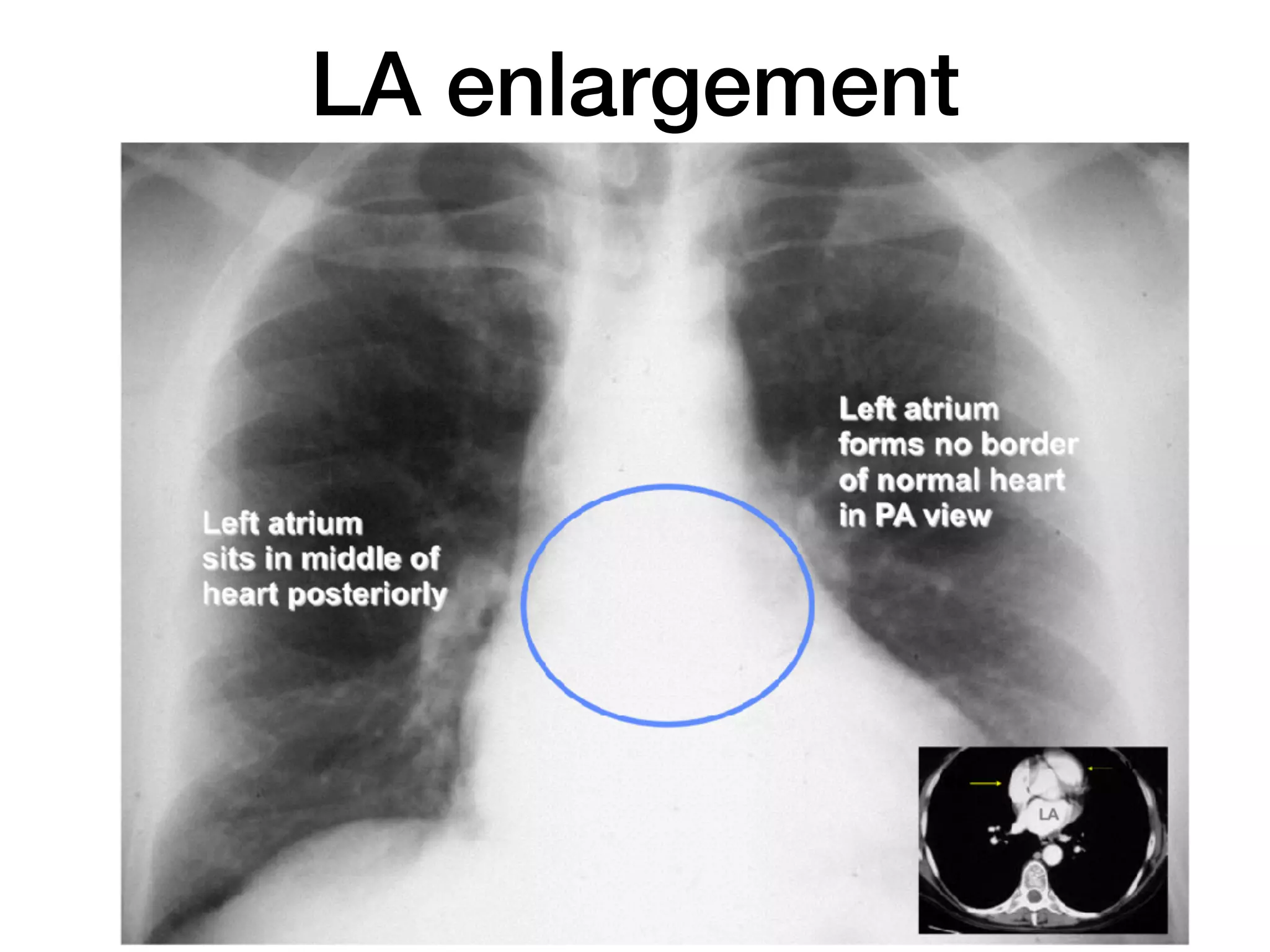 Chest film in cardiovascular system | PPT