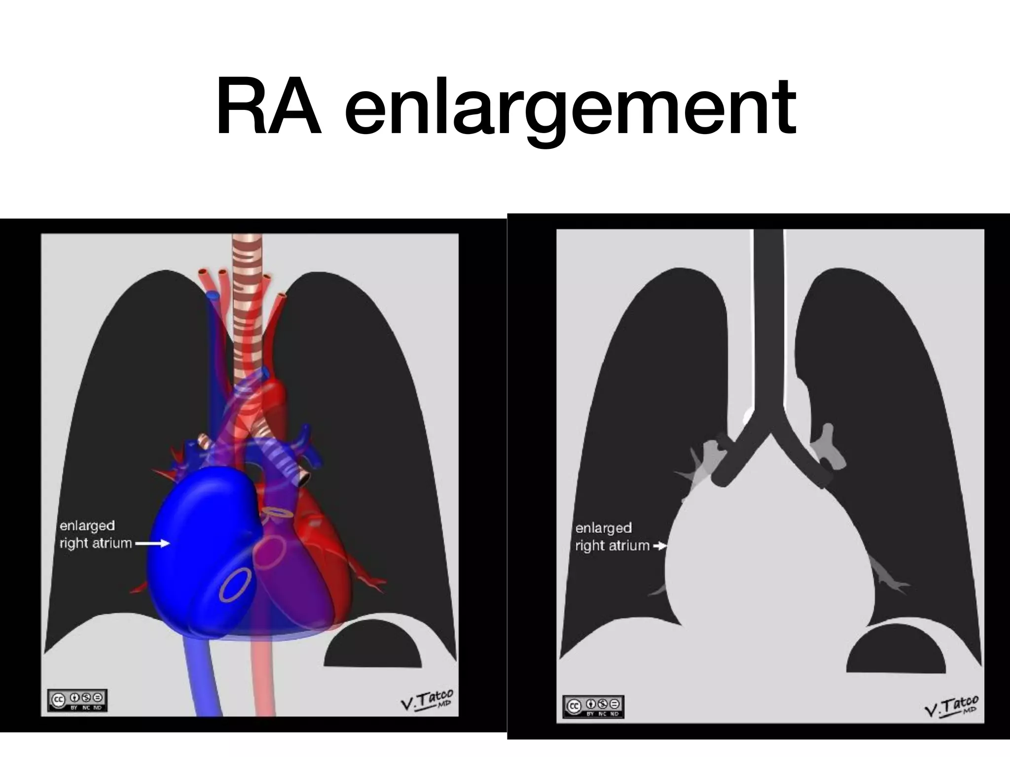 Chest film in cardiovascular system | PDF
