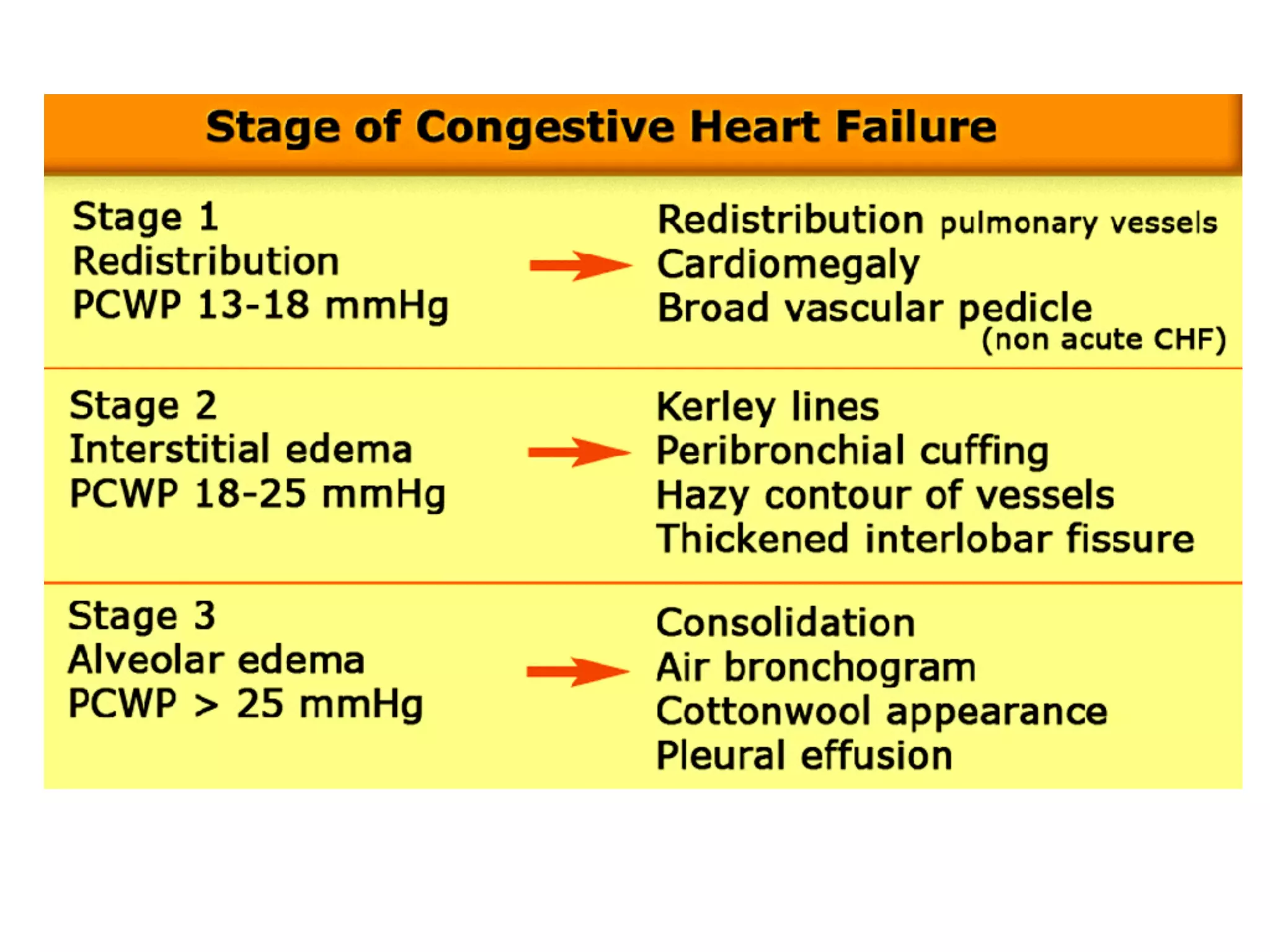 Chest film in cardiovascular system | PPT