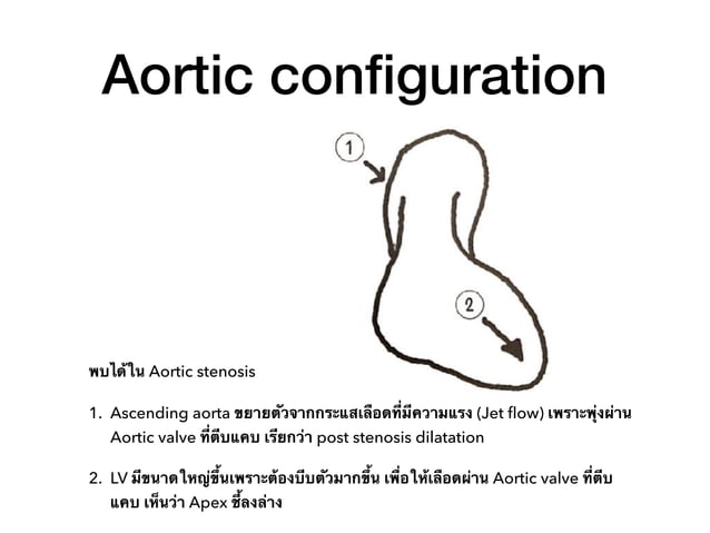 Chest film in cardiovascular system | PPT
