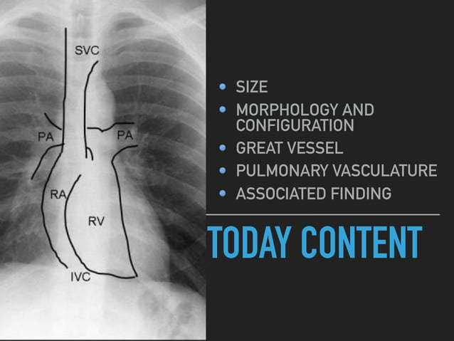 Chest film in cardiovascular system | PPT