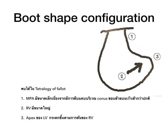 Chest film in cardiovascular system | PPT