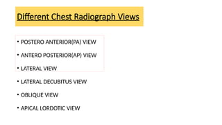 chest xray ppt final for radiology residents | PPTX