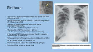 CXR Presentation.pptx