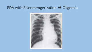 CXR Presentation.pptx | Free Download