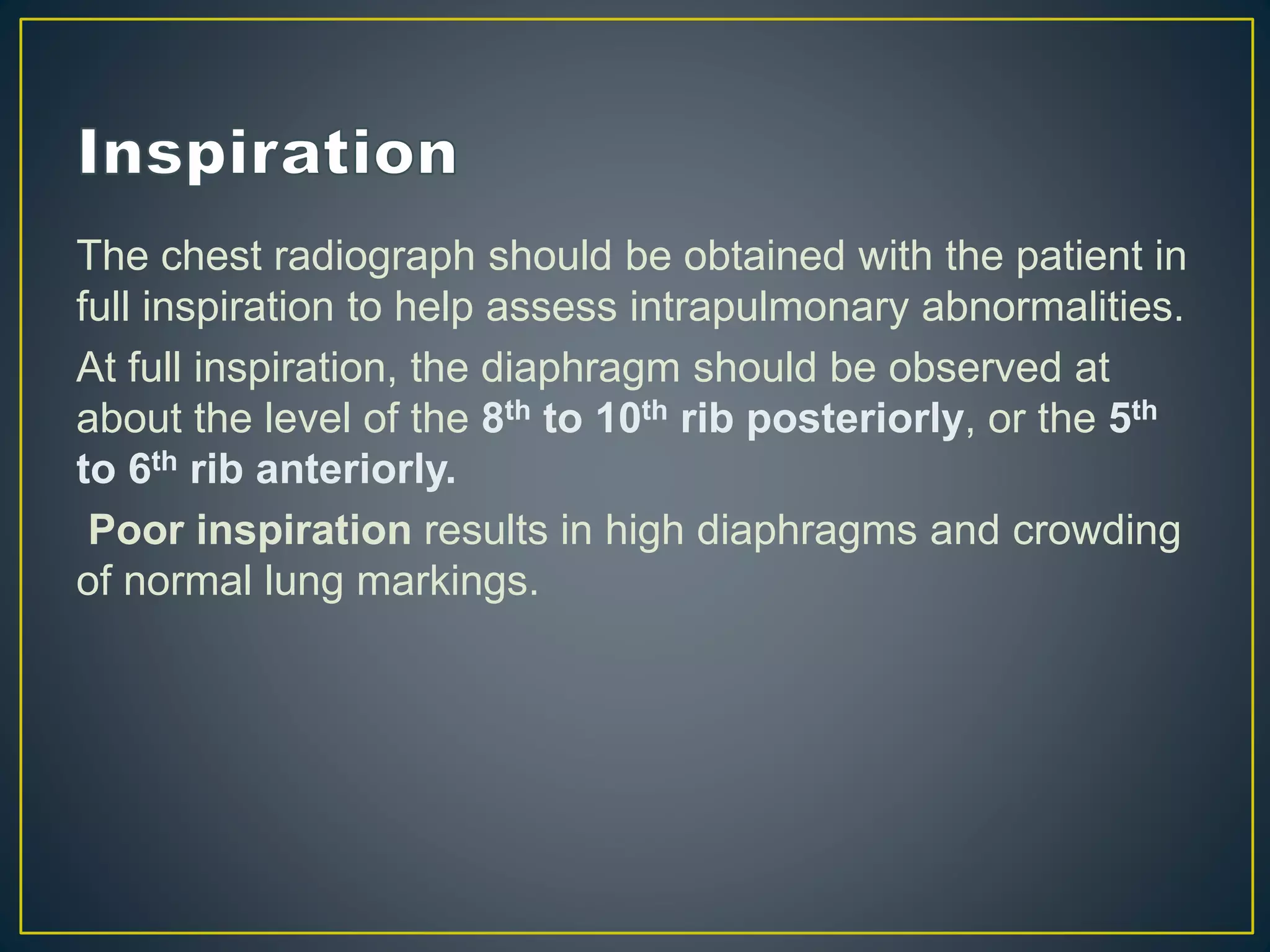 Chest x ray - basics | PPTX
