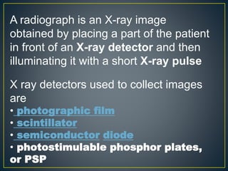 Chest x ray - basics | PPTX
