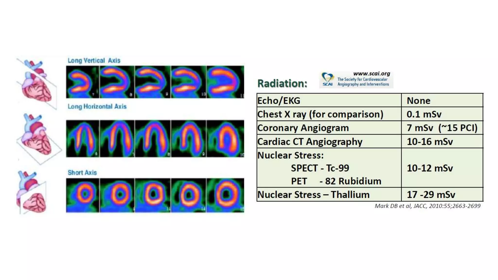 CT Coronary Angiogram VS Cardiac Stress Test | PPT