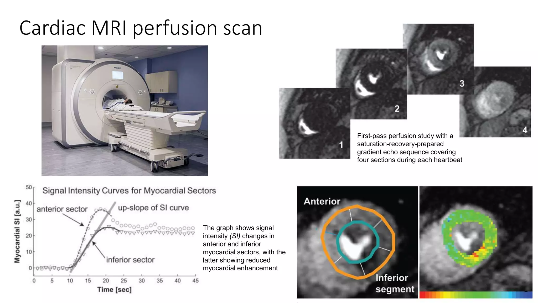 CT Coronary Angiogram VS Cardiac Stress Test | PPTX