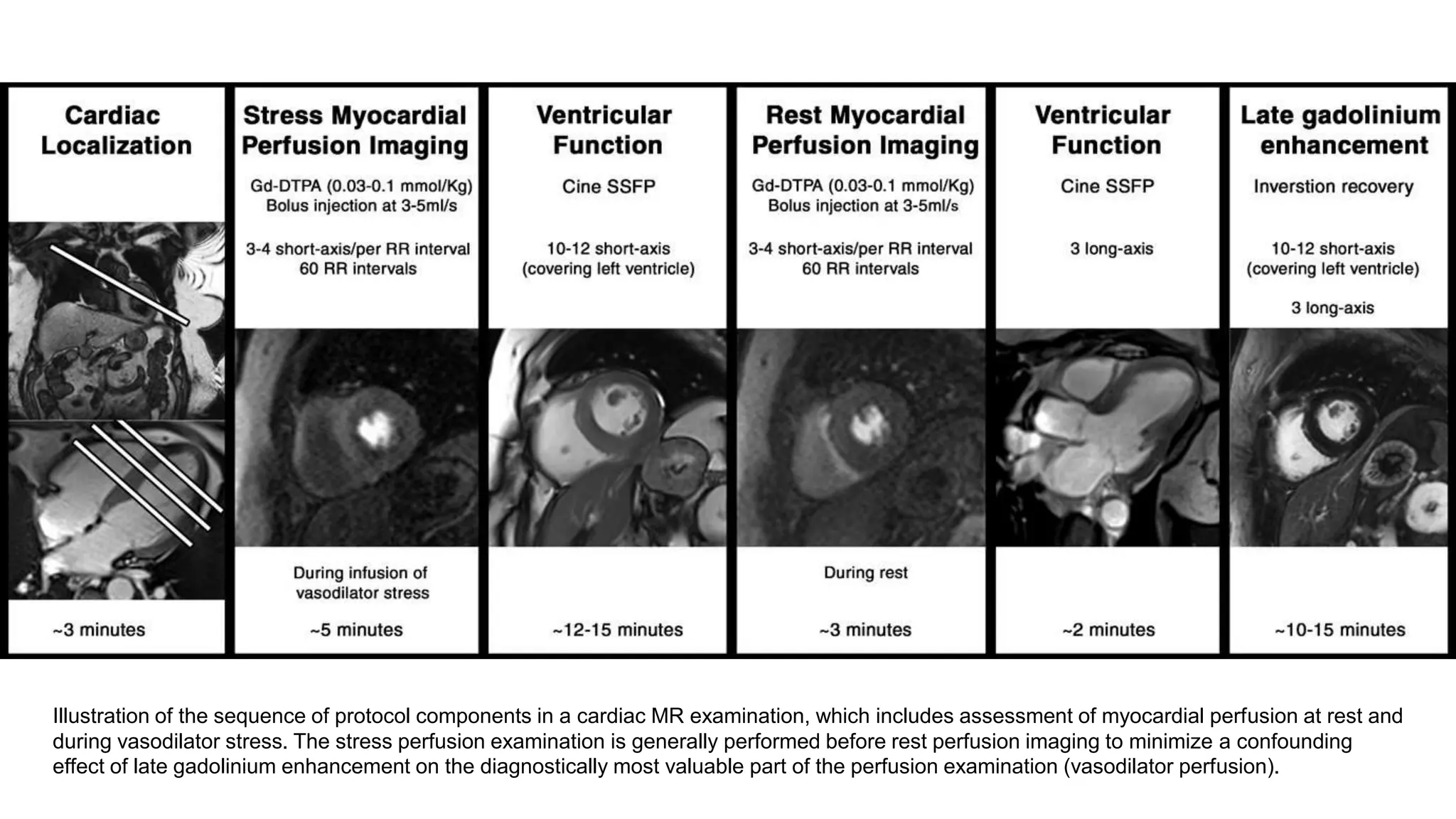 CT Coronary Angiogram VS Cardiac Stress Test | PPTX
