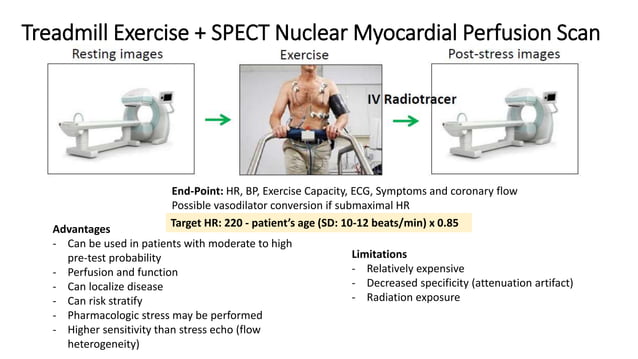 CT Coronary Angiogram VS Cardiac Stress Test | PPTX
