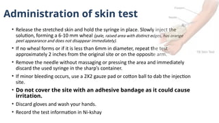 Cy TB standard operating procedure in India | PPTX