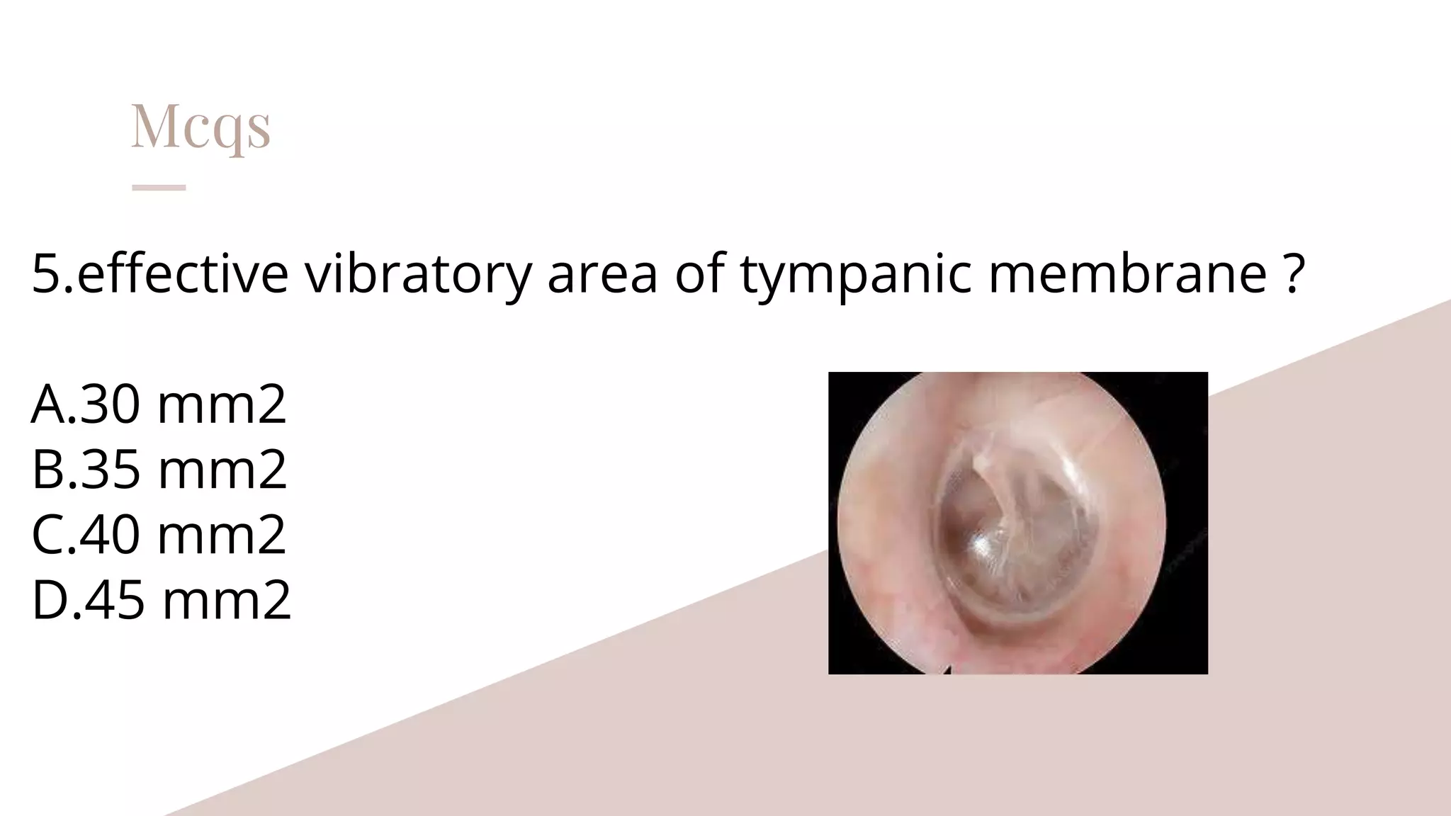 Tympanic membrane | PPTX