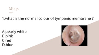 Tympanic membrane | PPTX