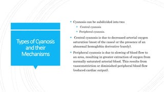 Cyanosis | PPTX