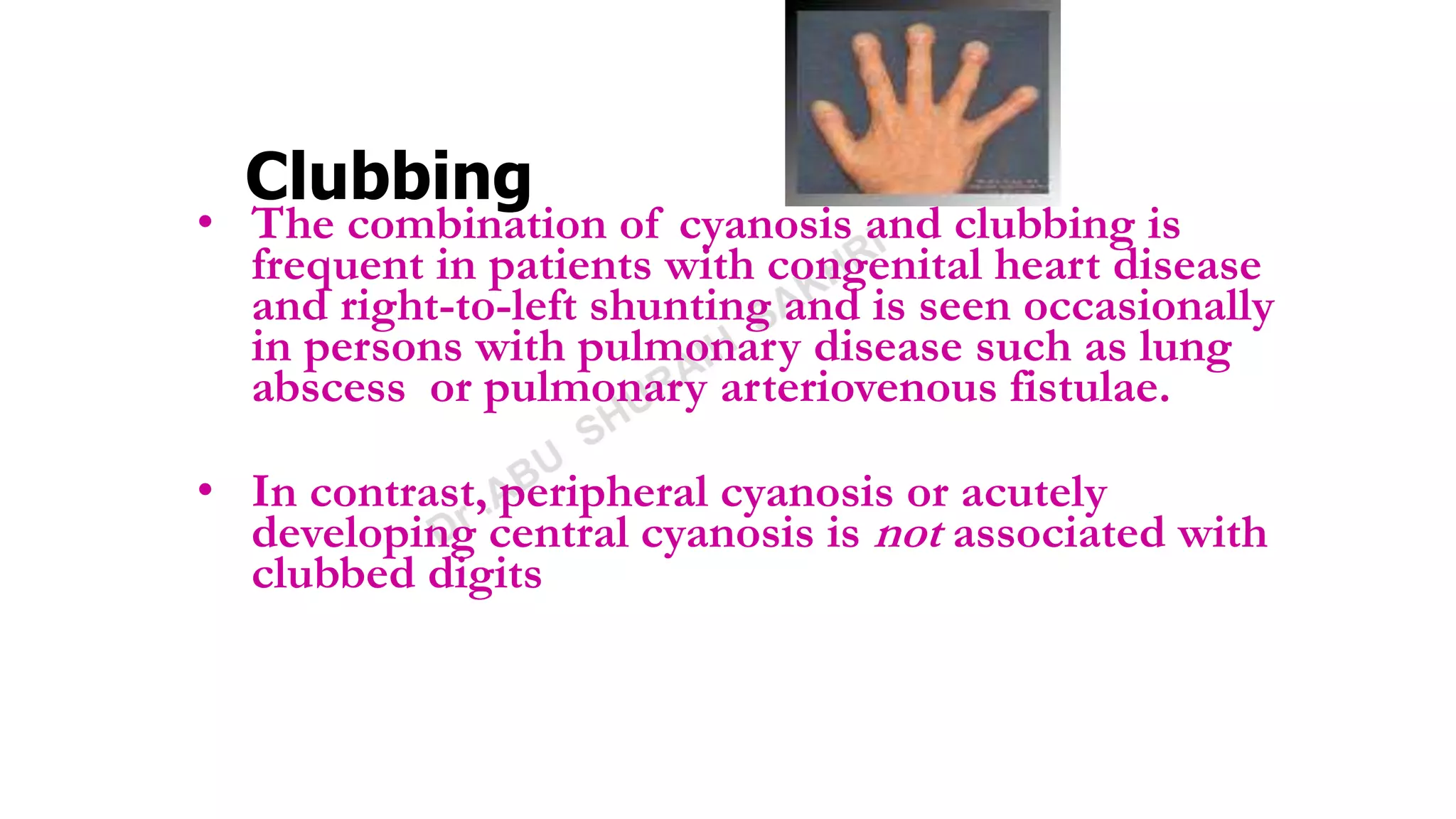 Cyanosis | PPT