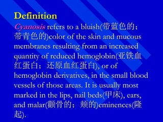 cyanosis.ppt
