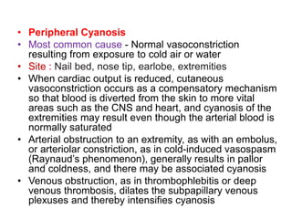 cyanosis.pptx