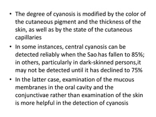 cyanosis.pptx